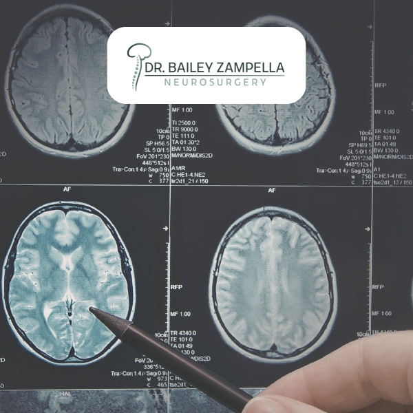 Understanding Functional Neurosurgery: How Modern Techniques Restore ...
